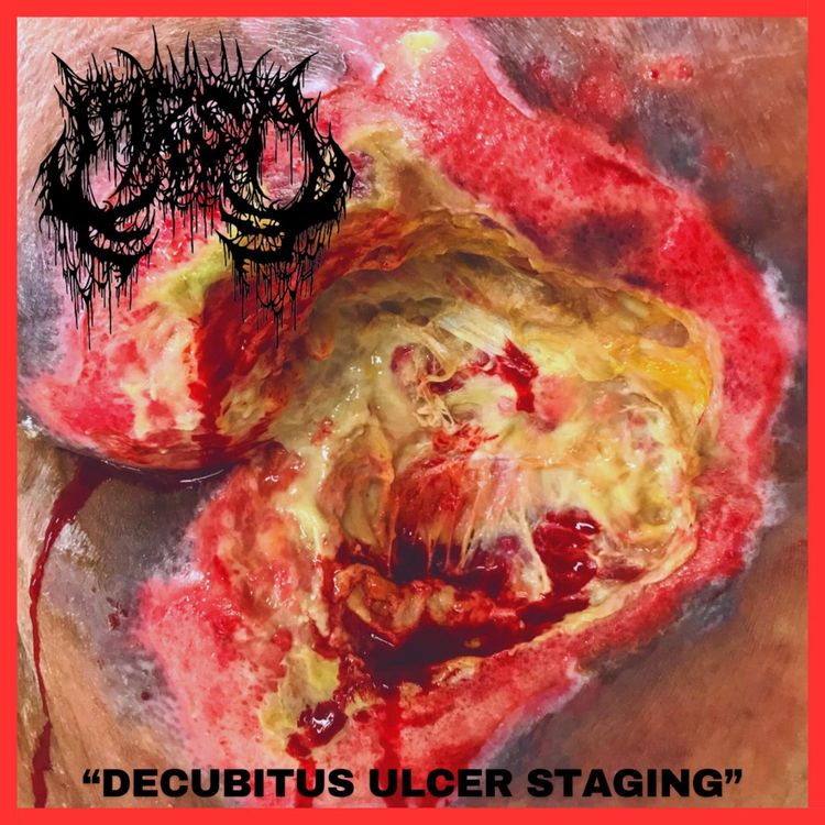MRSA - Decubitus Ulcer Staging (EP) - Reviews - Album of The Year